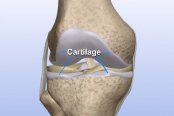 Knee – Ali Orthopedics