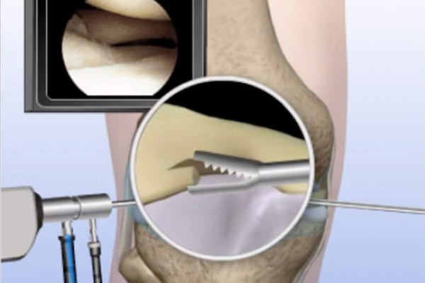 Knee – Ali Orthopedics